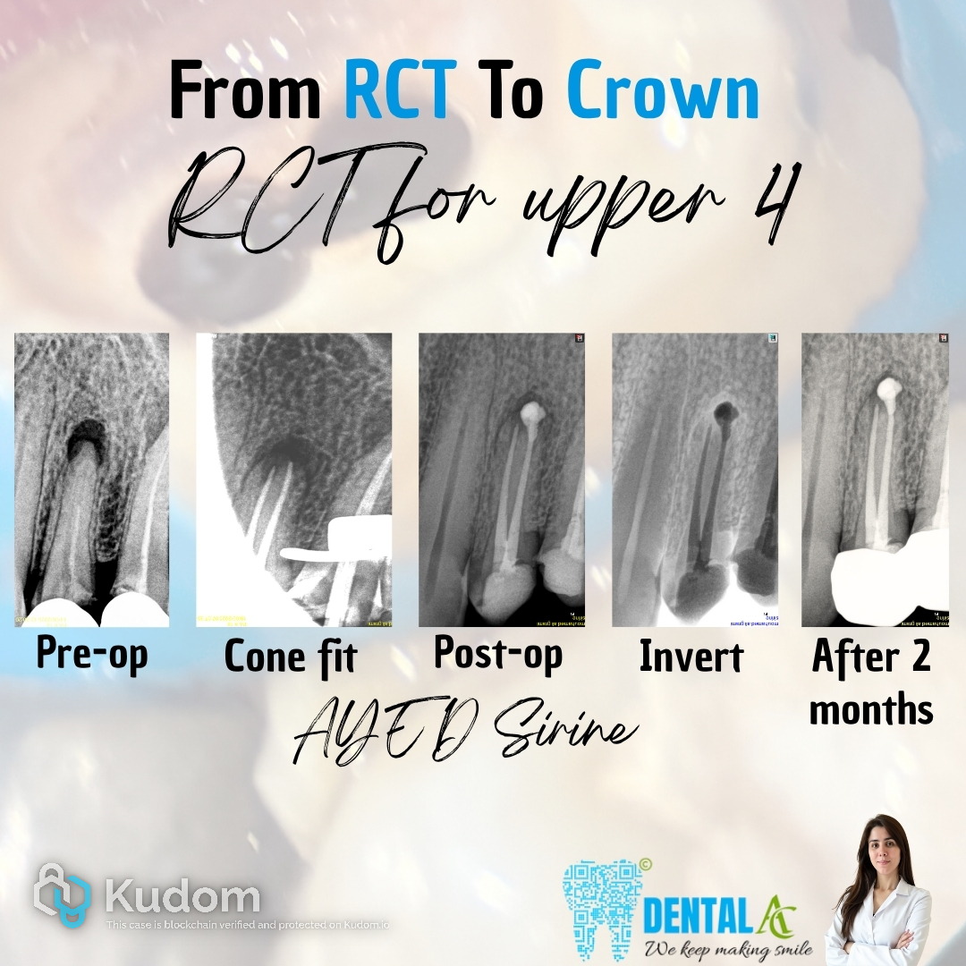Kudom | Resolving Apical Pathology Through Precision Retreatment: A ...